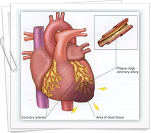 Understanding different types of heart diseases