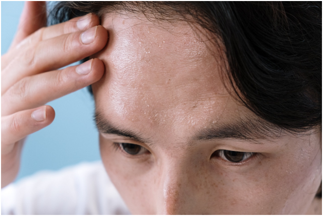 Cold Stress Symptoms & Tips to Avoid Them