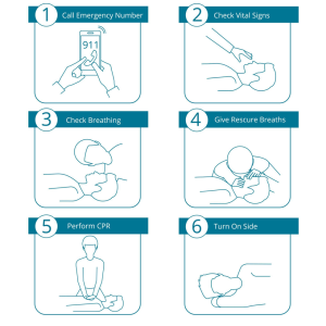 The Race Against Time: What Happens to the Body After 4 Minutes of CPR?